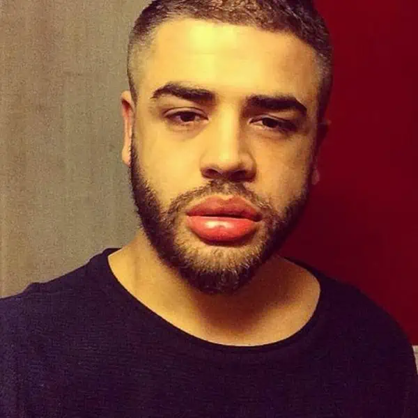 Noizy Foto